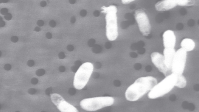 ‘Almost too late’ to halt spread of antibiotic resistant bacteria found ...