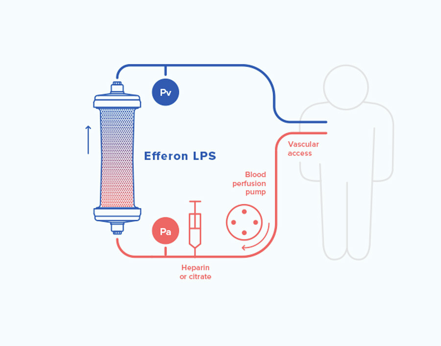 Russian scientists develop unique tool to combat blood poisoning ...